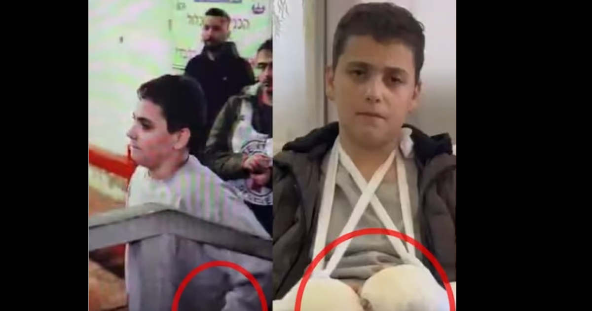 young detainee released from israeli prison with broken arms ...